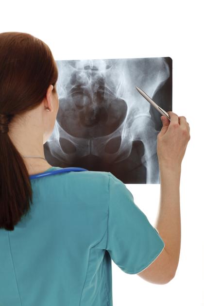 Osteoporoosi haurastuttaa luuta | Terve.fi