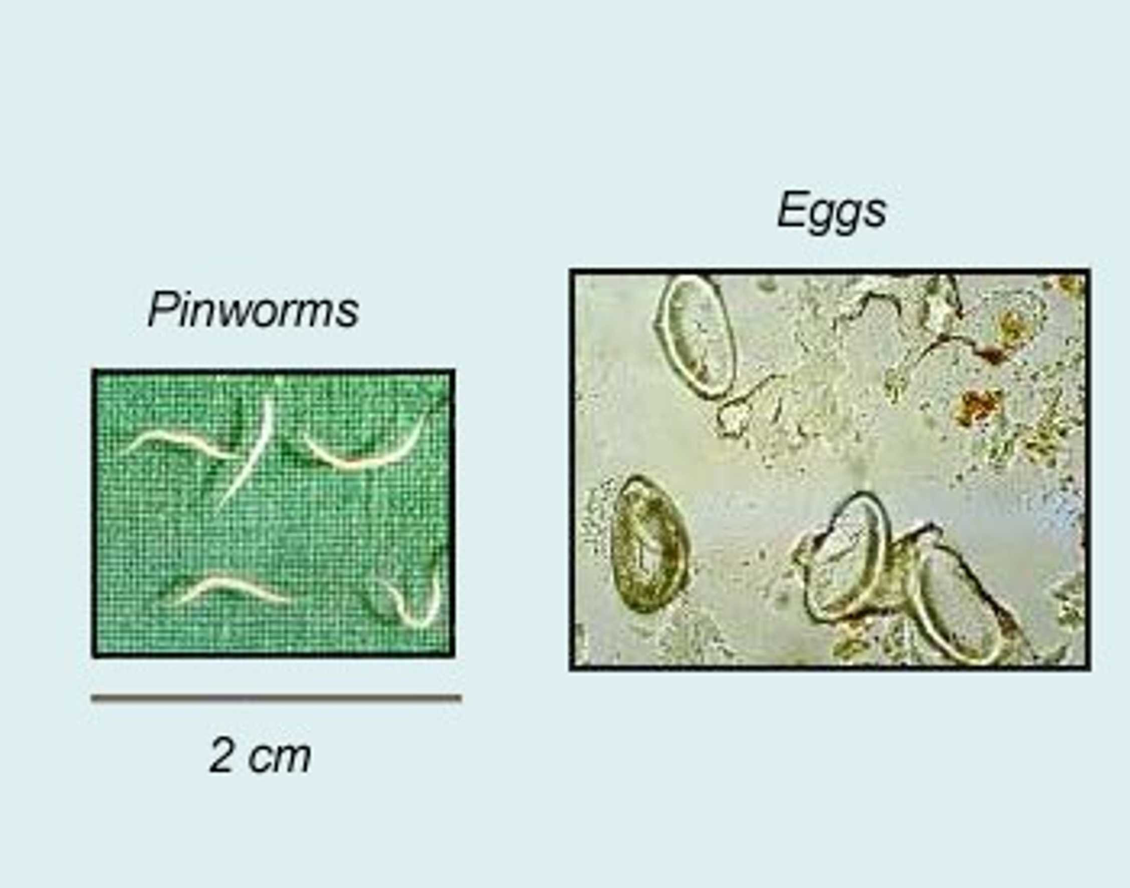 Kihomadot -potilasohje | Terve.fi