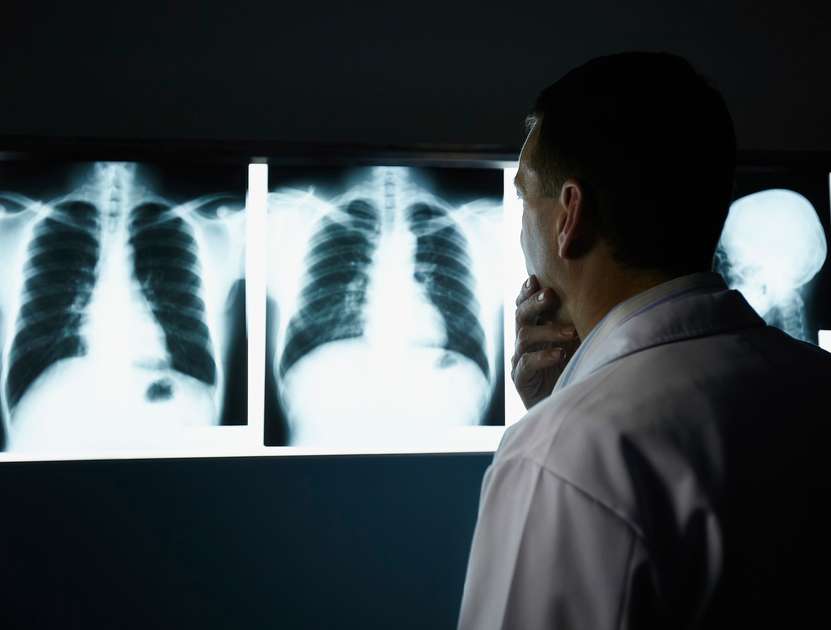 Faktat haltuun: Keuhkot | Terve.fi