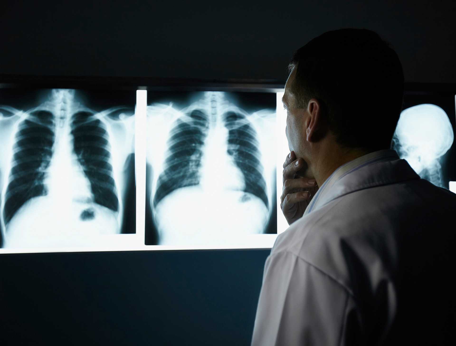 Faktat haltuun: Keuhkot | Terve.fi