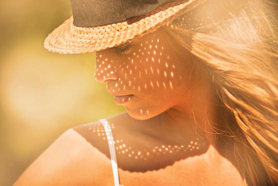 Auringon polttama iho | Terve.fi