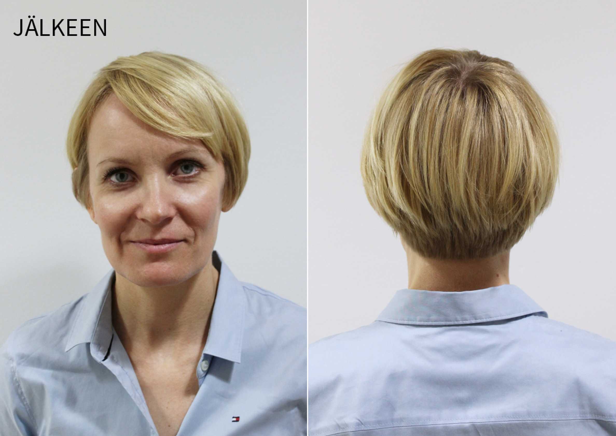 Katso, kuinka lyhyt hiusmalli tekee ihmeitä kasvoille! | Terve.fi